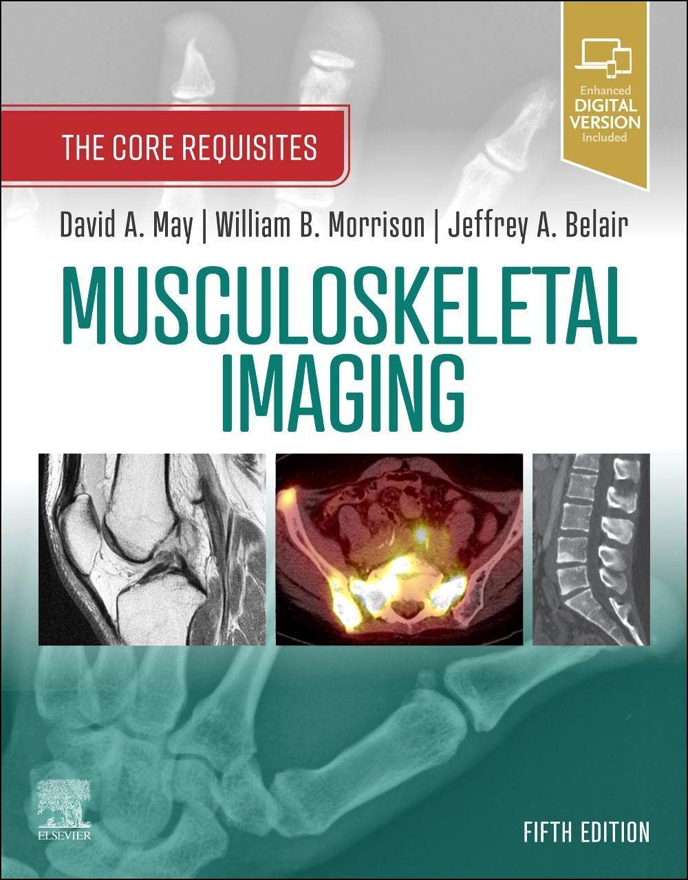 Musculoskeletal Imaging: The Core Requisites: 9780323680592: Medicine ...
