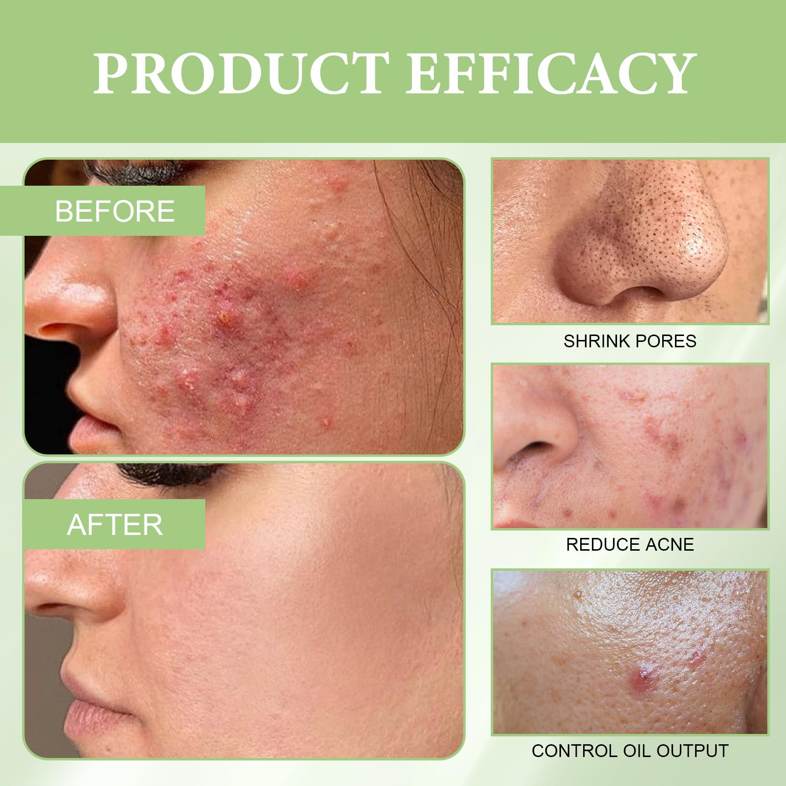 Purifying Exfoliating Gel Pore-Shrinking, Moisturizing Skin Cleanser ...