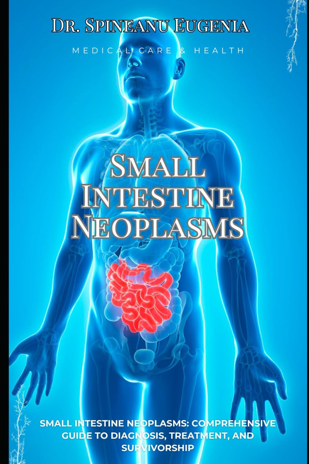 Compare small intestine neoplasms: comprehensive guide to diagnosis ...