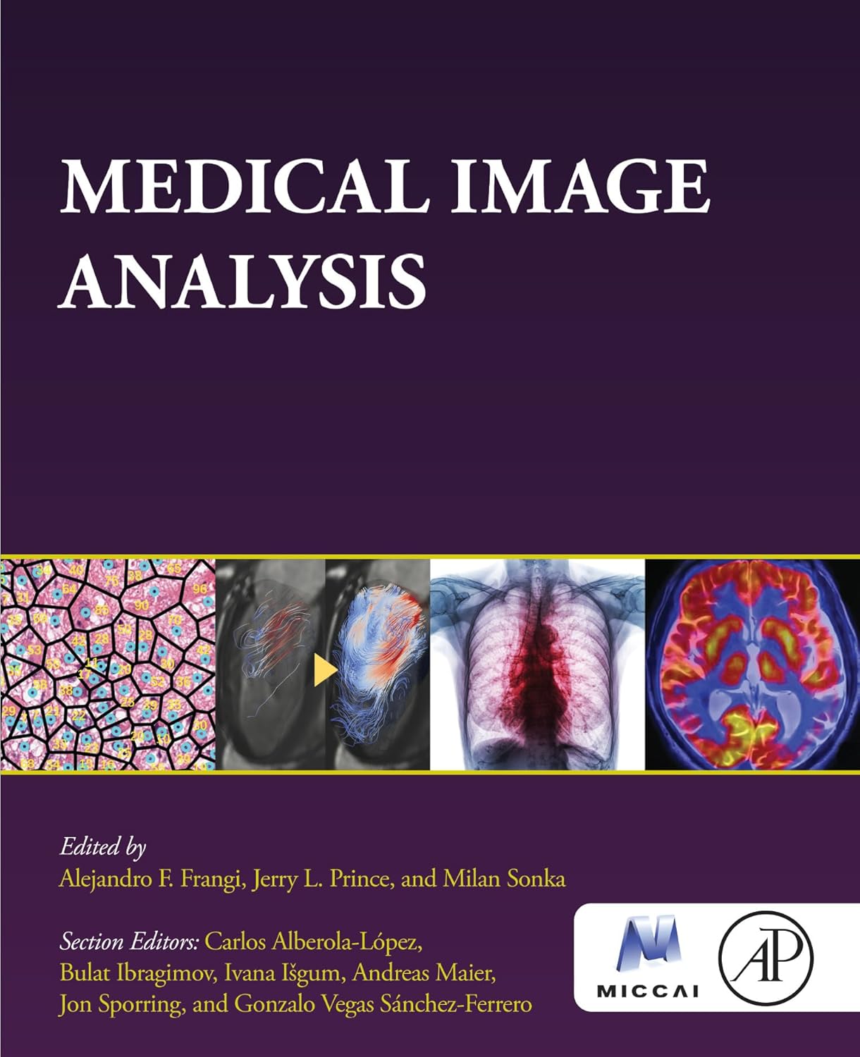 Medical Image Analysis (The MICCAI Society book Series) - Kindle edition by Frangi, Alejandro ...