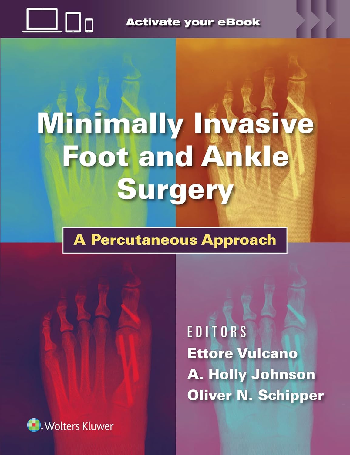 Minimally Invasive Foot and Ankle Surgery: A Percutaneous Approach ...