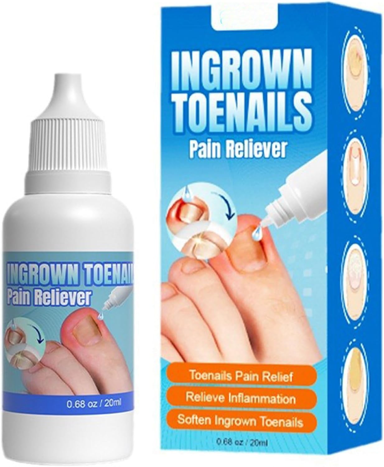 Ingrown Toenail Treatment Extra Strong - Ingrown Toenail Drop- Cuticle ...