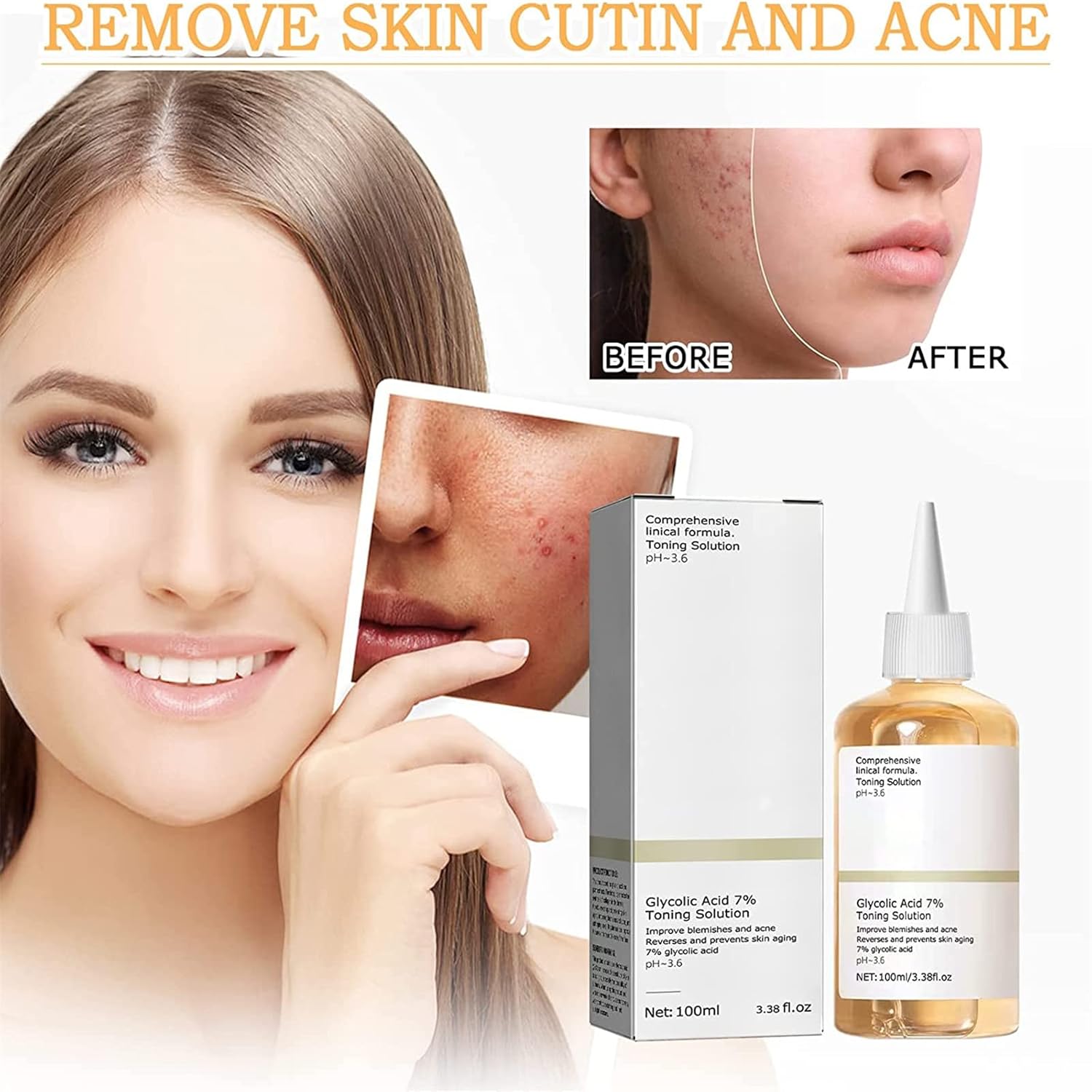 RJDJ 2023 New Glycolic Acid 7% Toning Resurfacing Solution, Ordinary ...