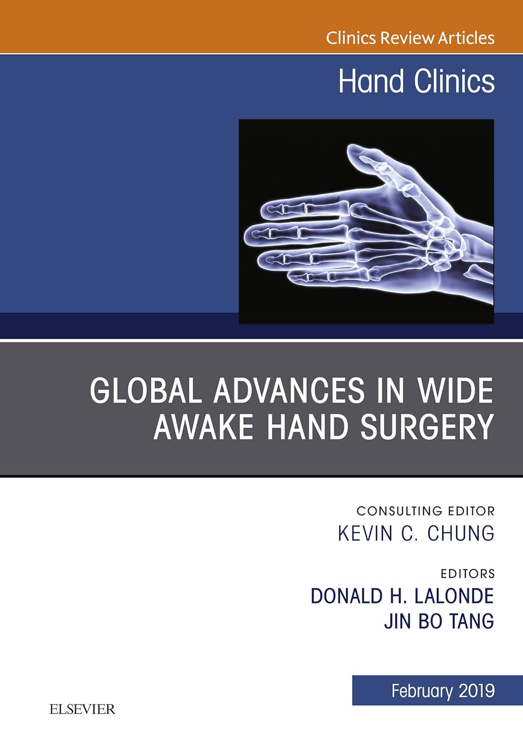 Amazon.com: Global Advances in Wide Awake Hand Surgery, An Issue of ...