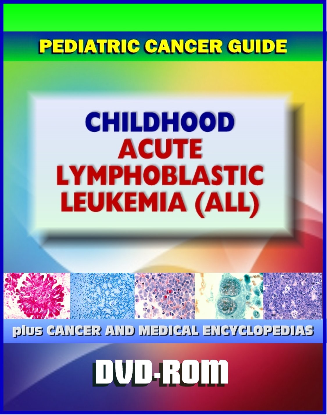 Childhood Acute Lymphoblastic Leukemia (ALL): Pediatric Cancer Guide to ...