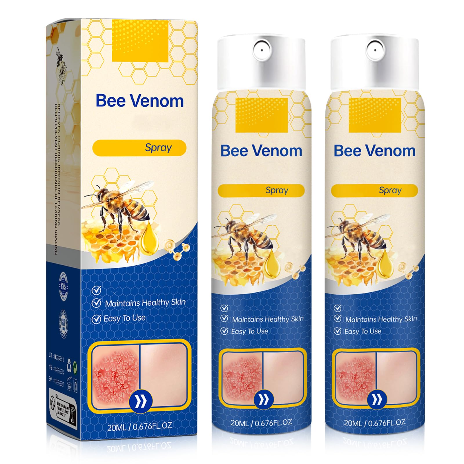 Amazon.com: Bee Venom Spray - 100% Pure Natural Bee Venom Repair Spray ...