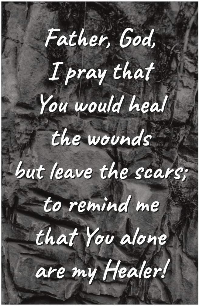 Amazon.com: Scars Inspirational Christian Poster-J43: Posters & Prints