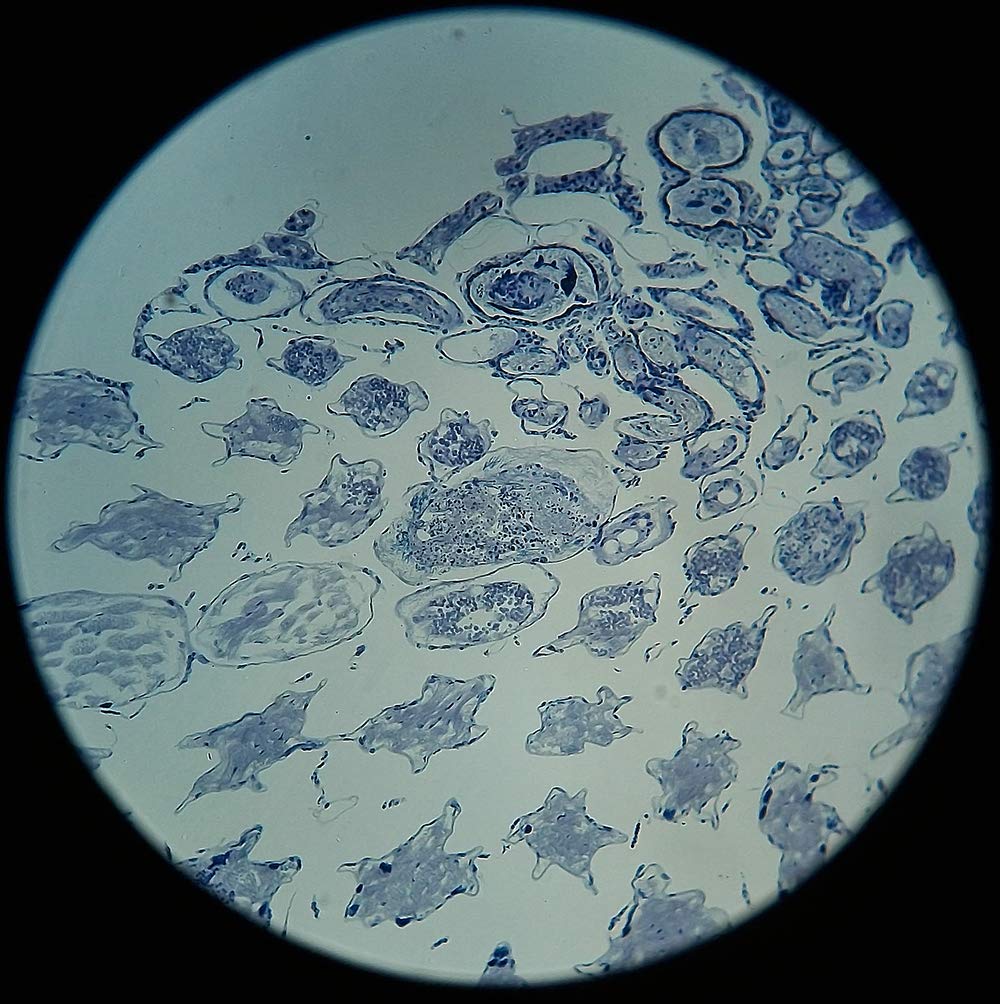 Snapklik.com : Prepared Animal Plant Cell Mitosis Meiosis Amitosis ...