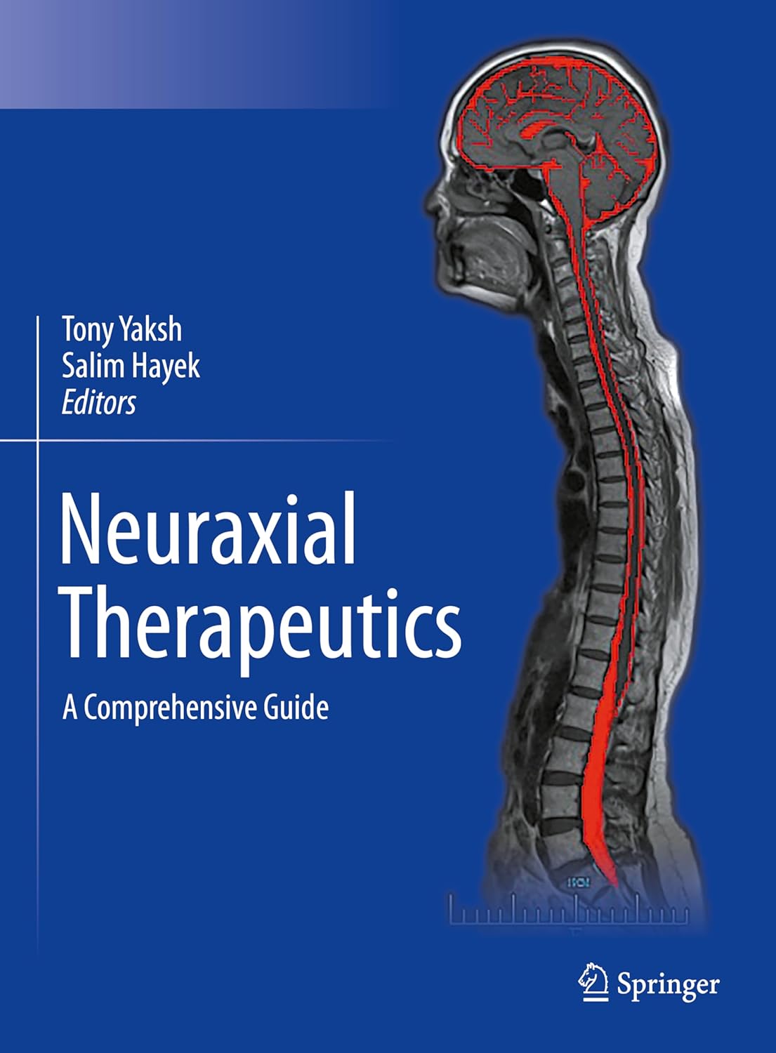 Neuraxial Therapeutics: A Comprehensive Guide: 9783031395574: Medicine ...