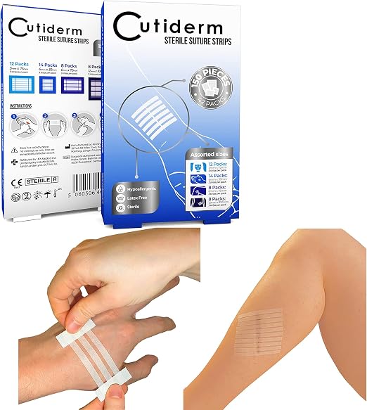 Cutiderm Wundnahtstreifen-Strips/Klammerpflaster Nahtmaterial ...