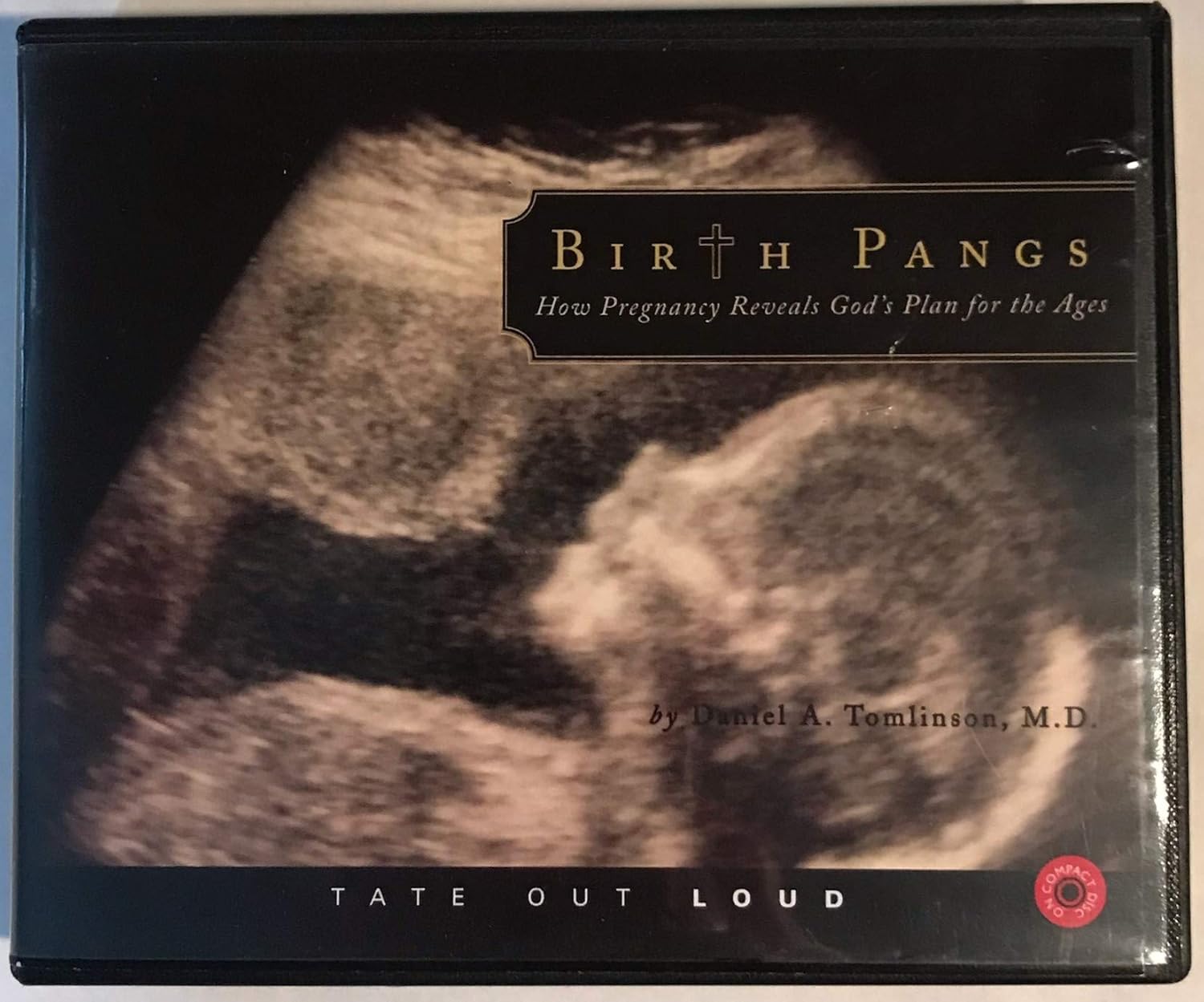 Amazon.com: Birth Pangs ~ How Pregnancy Reveals God's Plan for the Ages ...