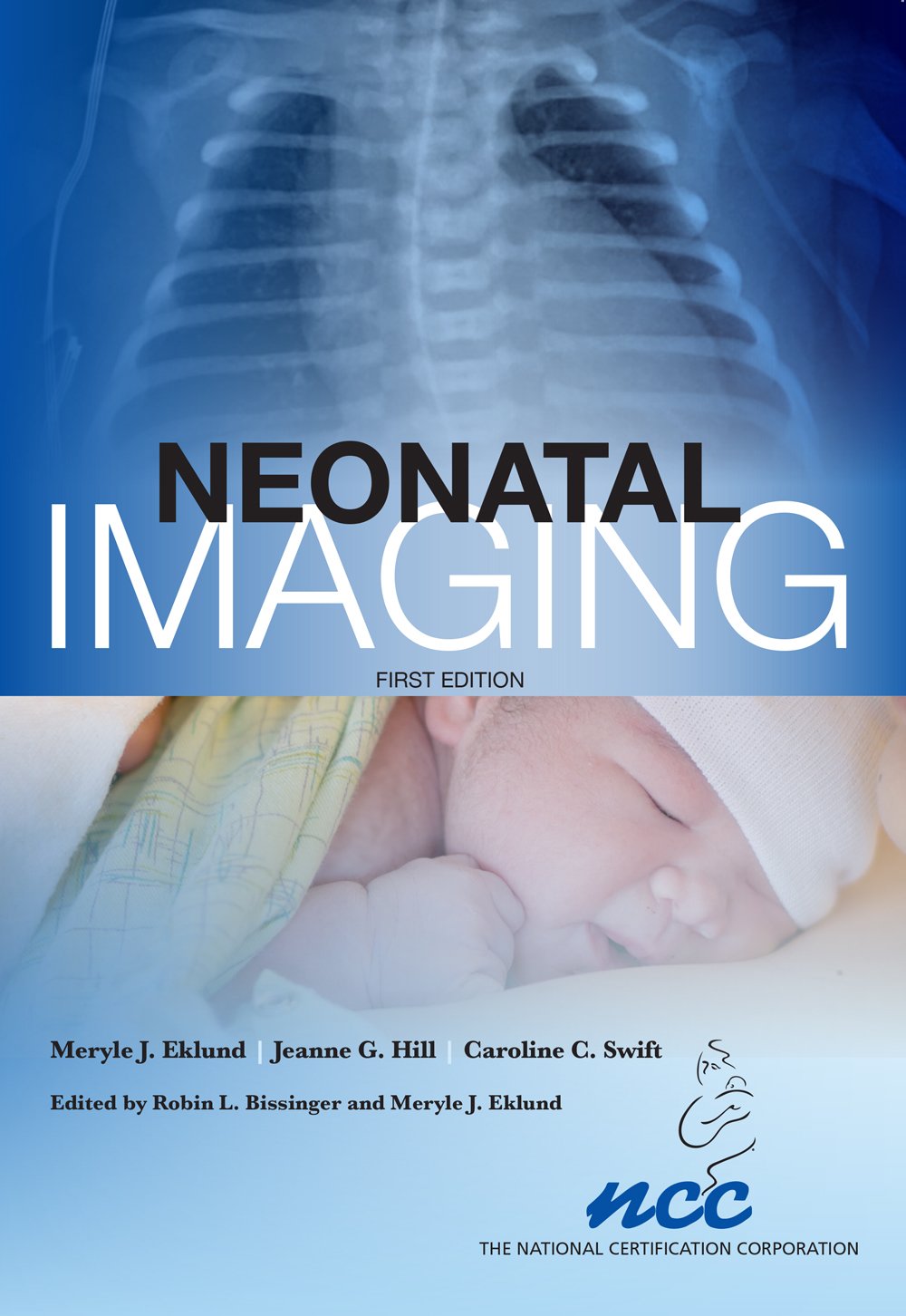 Neonatal Imaging: Meryle J. Eklund MD, Jeanne G. Hill, Caroline C ...
