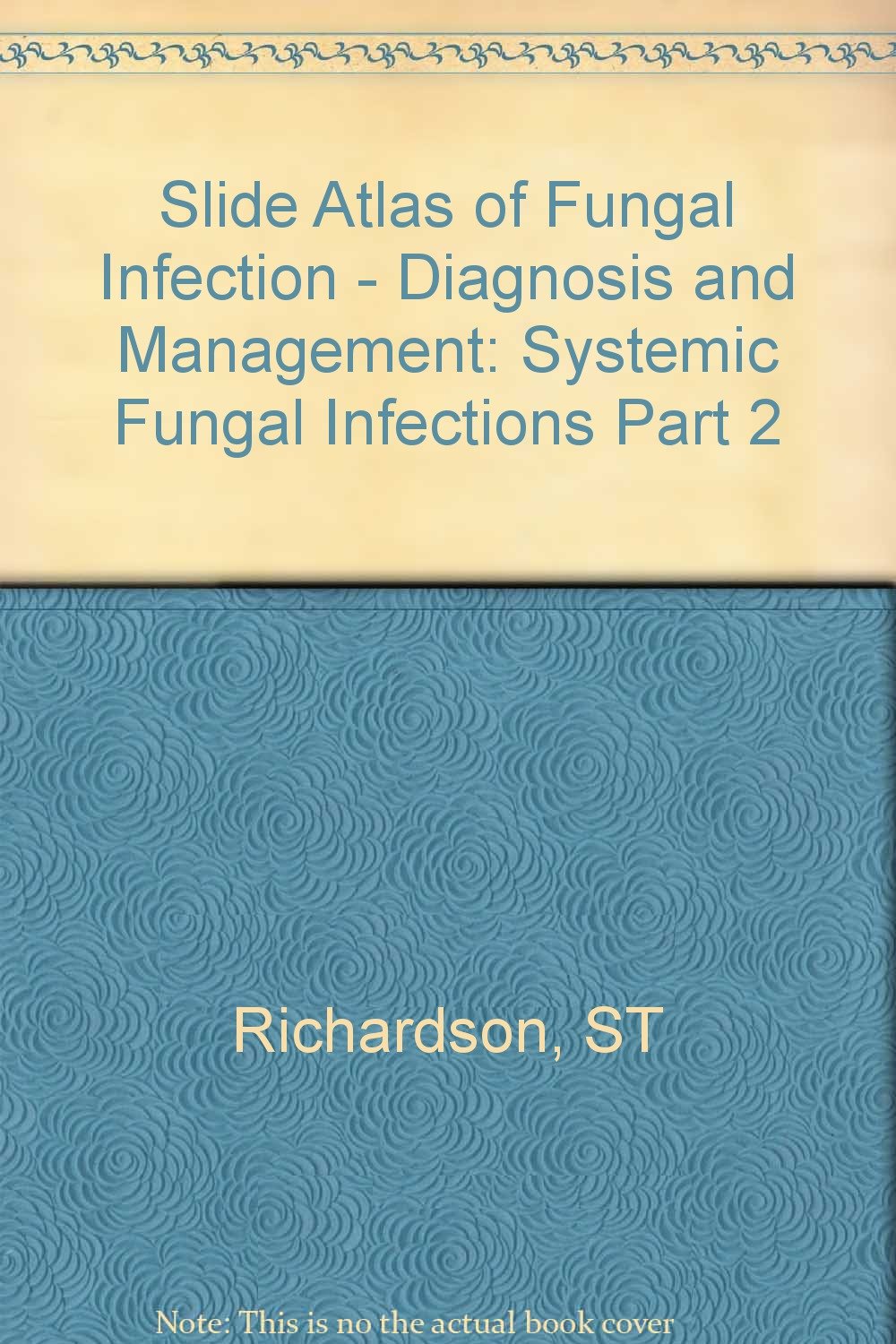 Slide Atlas of Fungal Infection - Diagnosis and Management: Systemic ...