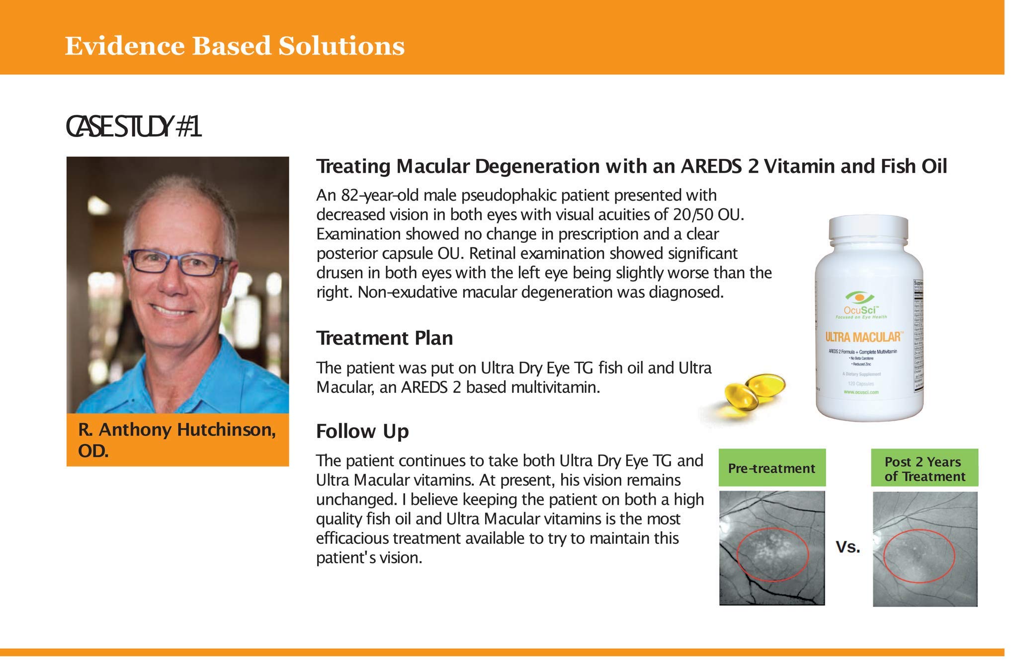 Ultra Macular - Ophthalmologist Recommended AREDS 2 Formula, Proven to ...