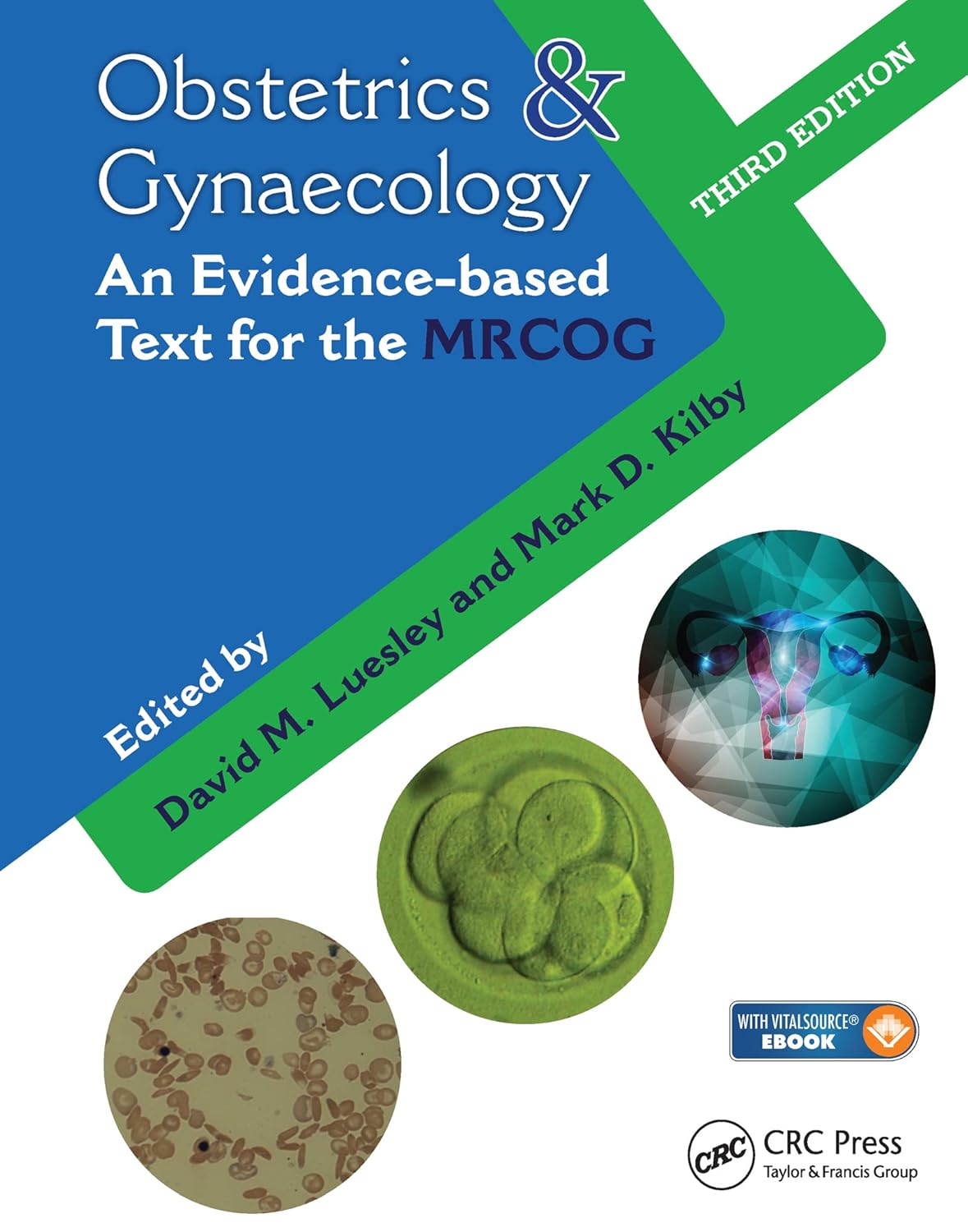 Obstetrics & Gynaecology: An Evidence-based Text for MRCOG, Third ...