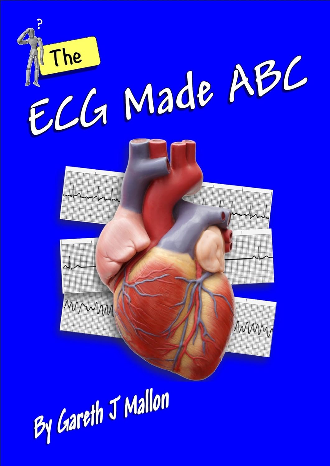 Amazon.com: The ECG Made ABC eBook : Mallon, Gareth: Books