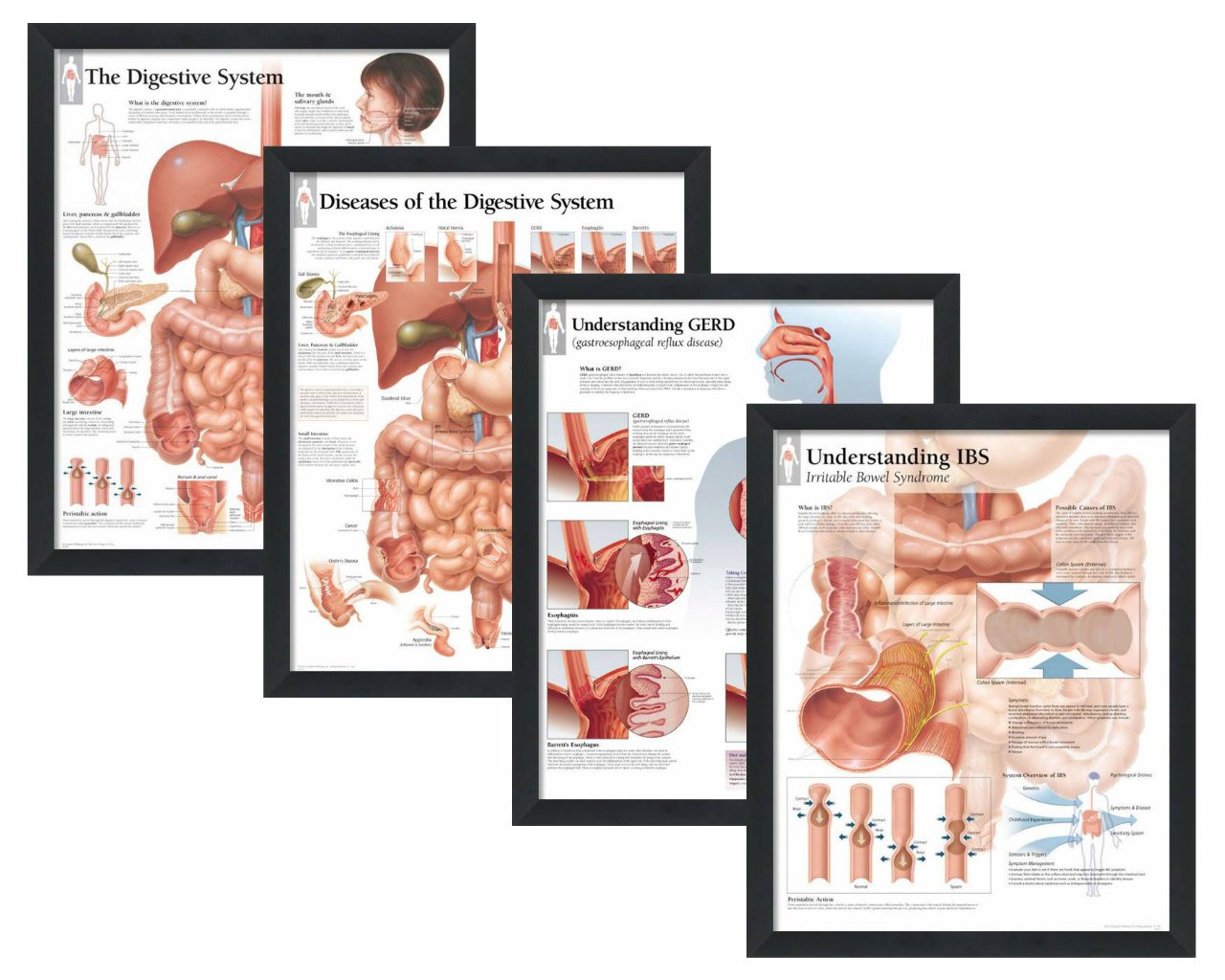 Buy Set of 4 Framed Medical s The Digestive System, Diseases of the ...