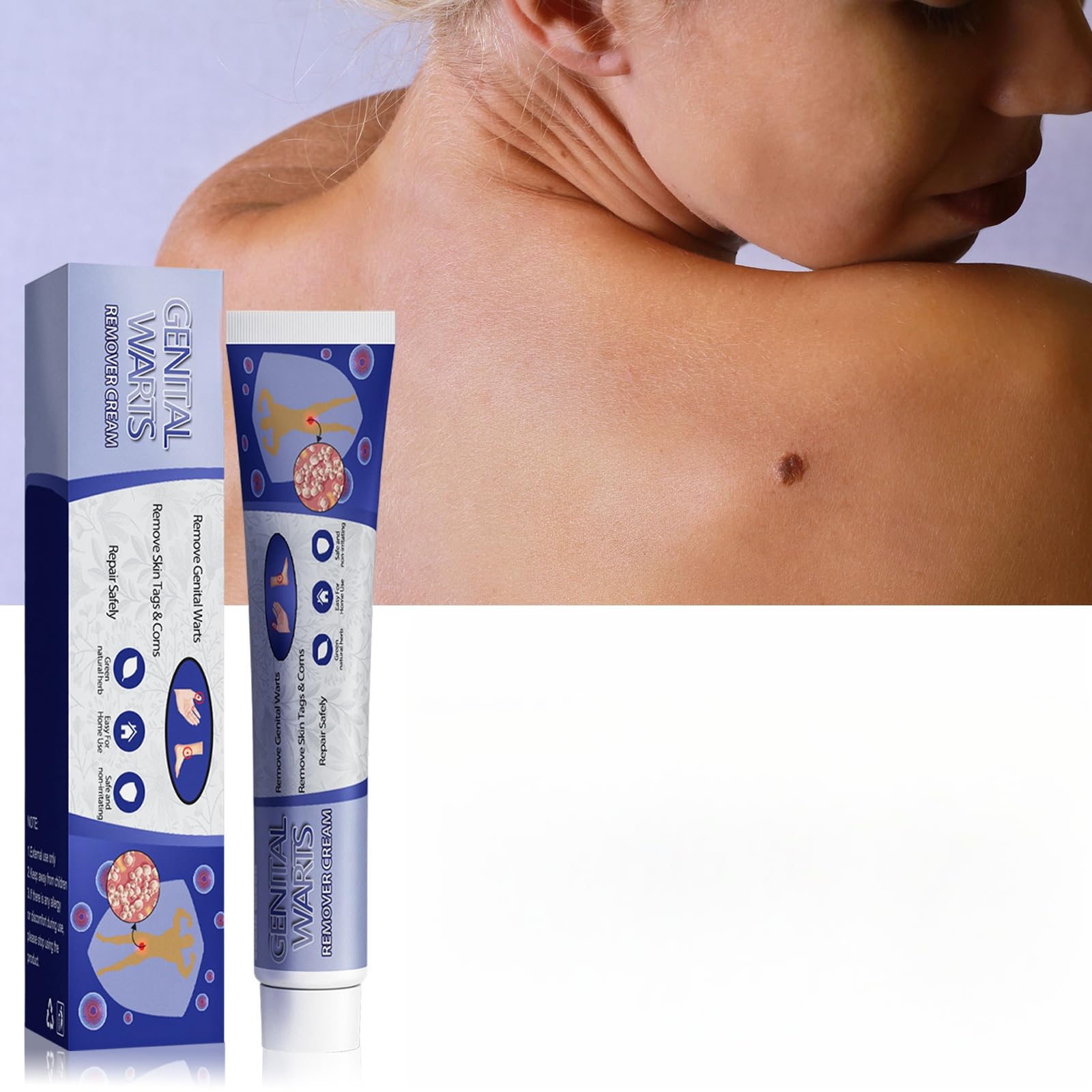 Skin Moles Removal Cream Massa,Mole Removal Cream For Moles On