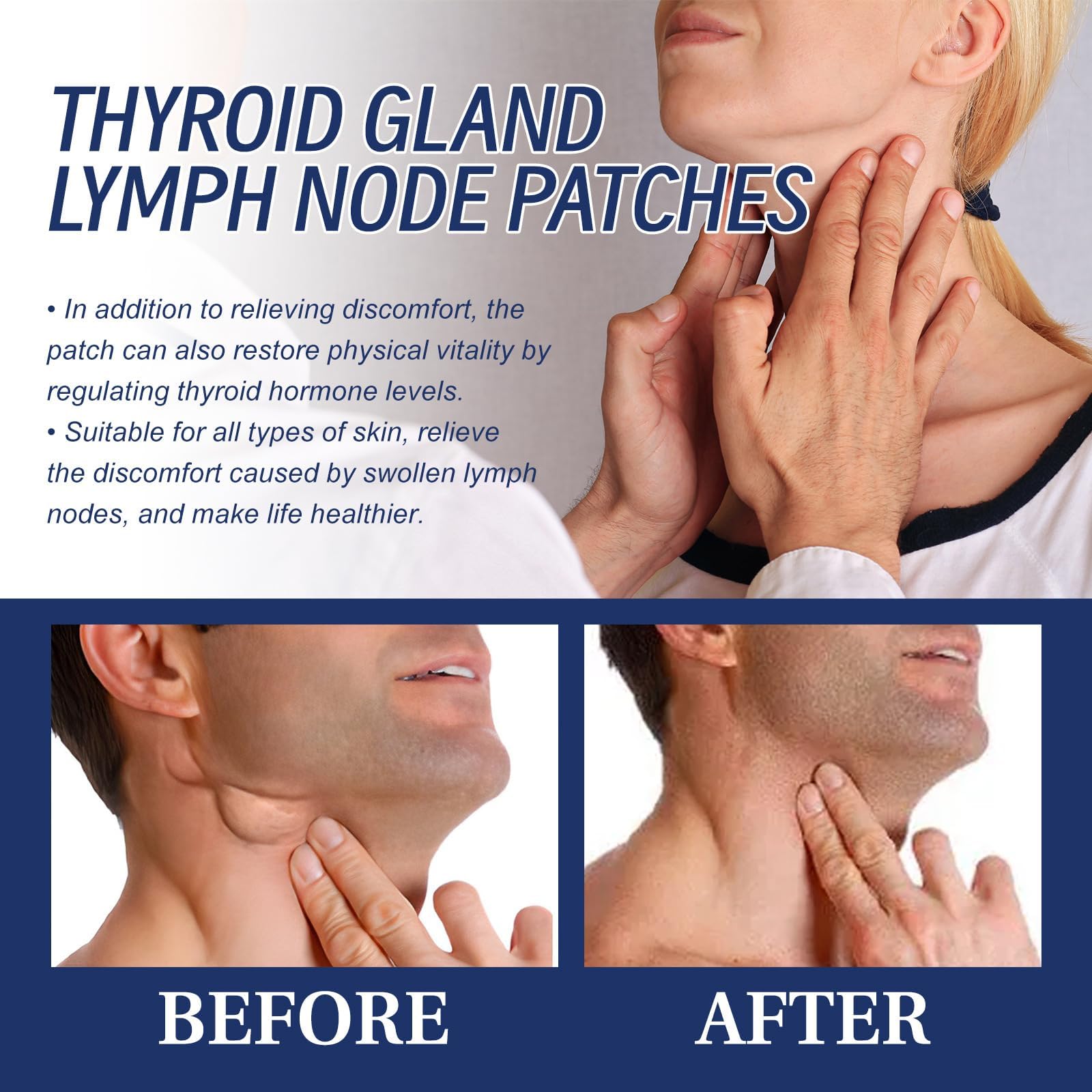 Pictures Of Swollen Thyroid Gland In Neck