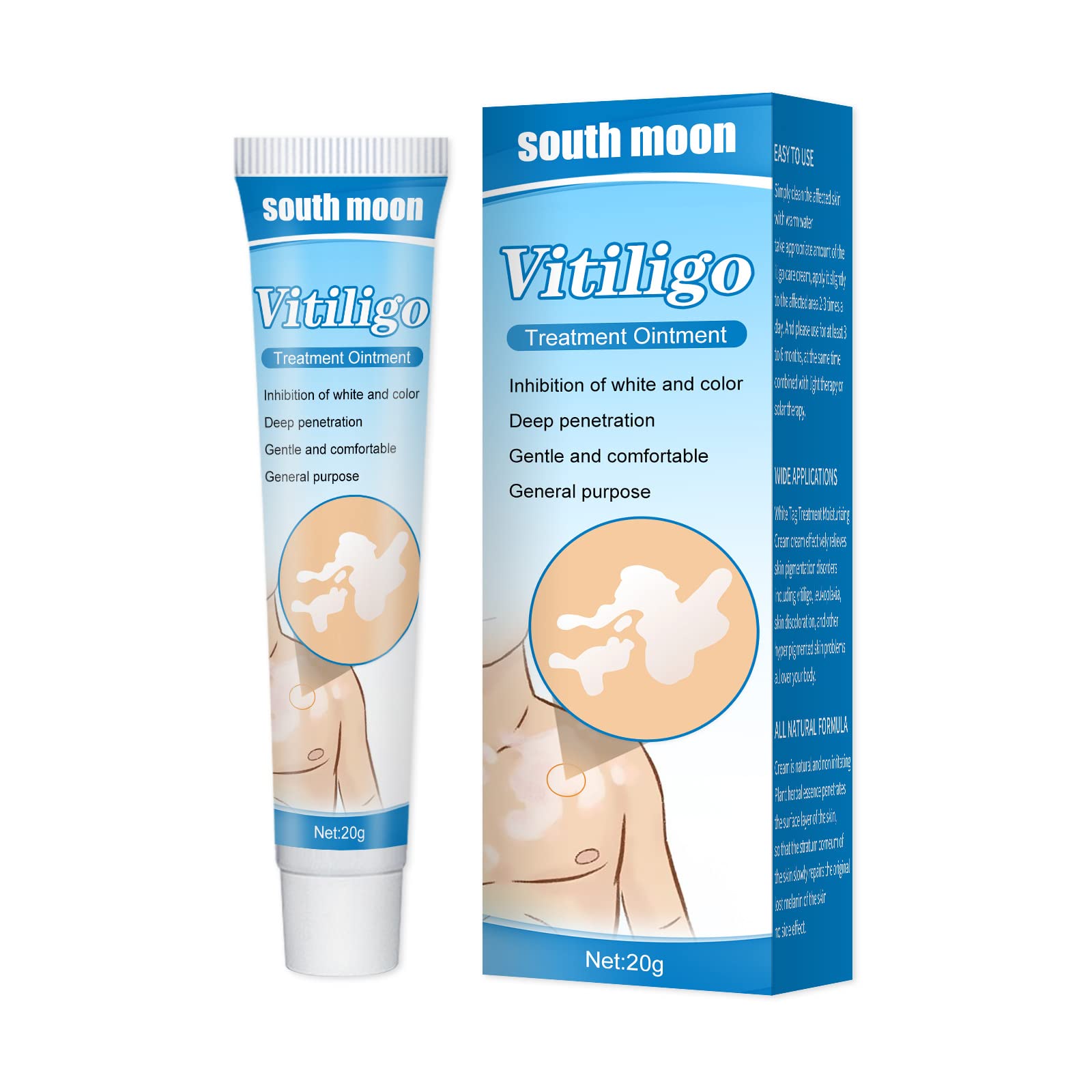 Buy Vitiligo ,Vitiligo Pigmentation Cream,Vitiligo Care Cream for Skin ...
