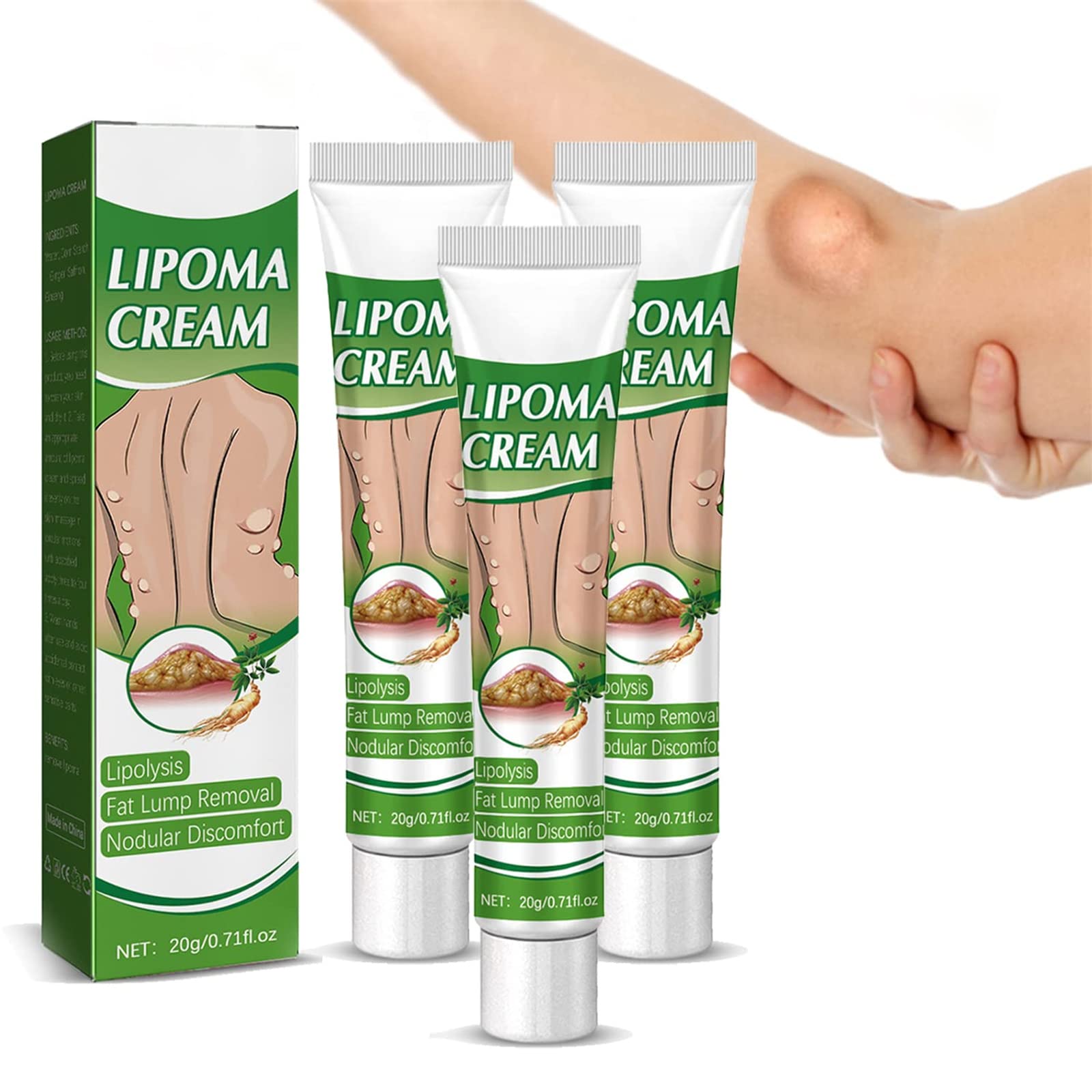 Lipomacure Soothing Ointment Lumpfree Lipoma Removal Cream Herbal ...