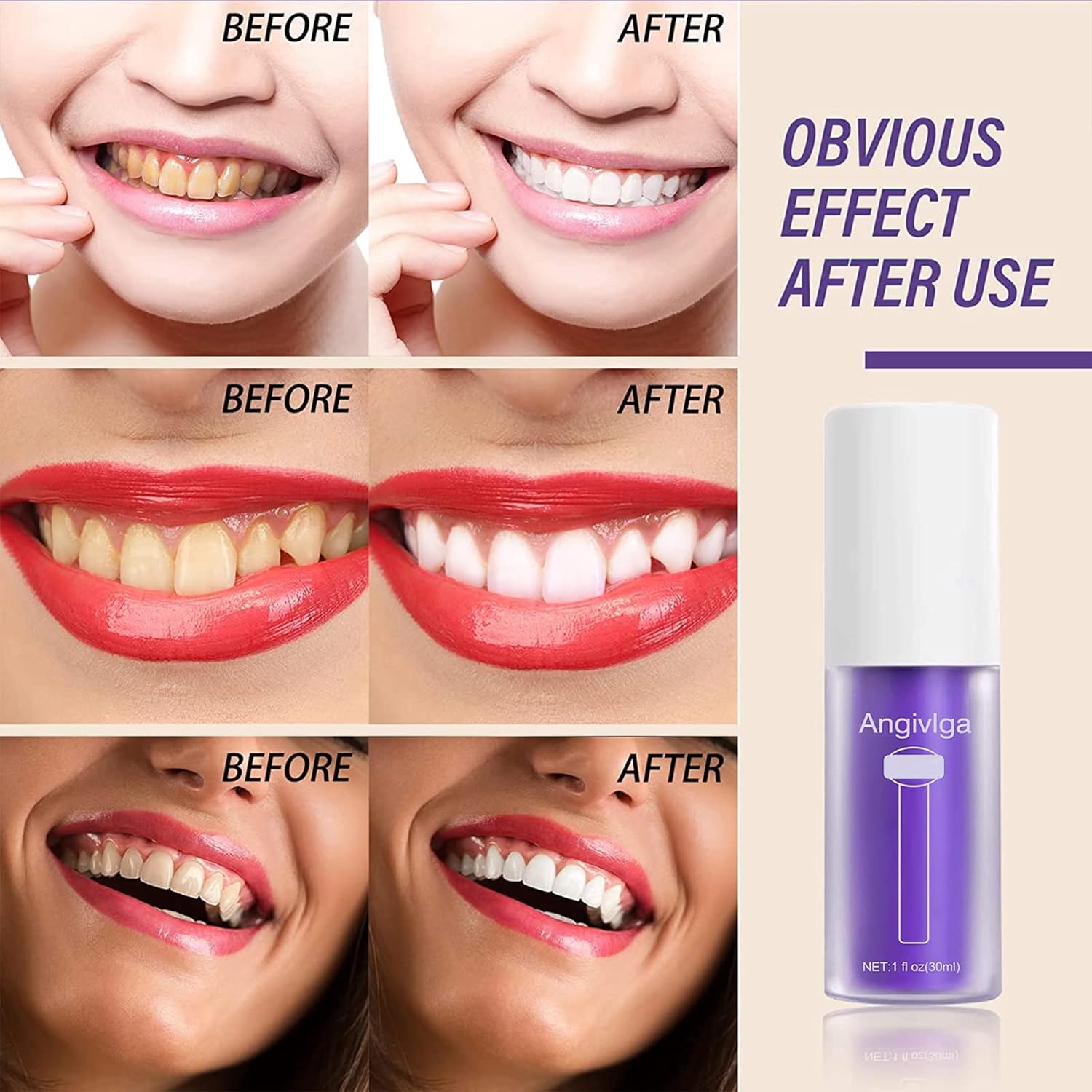 Teeth Whitening Corrector Toothpaste, Teeth Whitening Toothpaste Purple ...