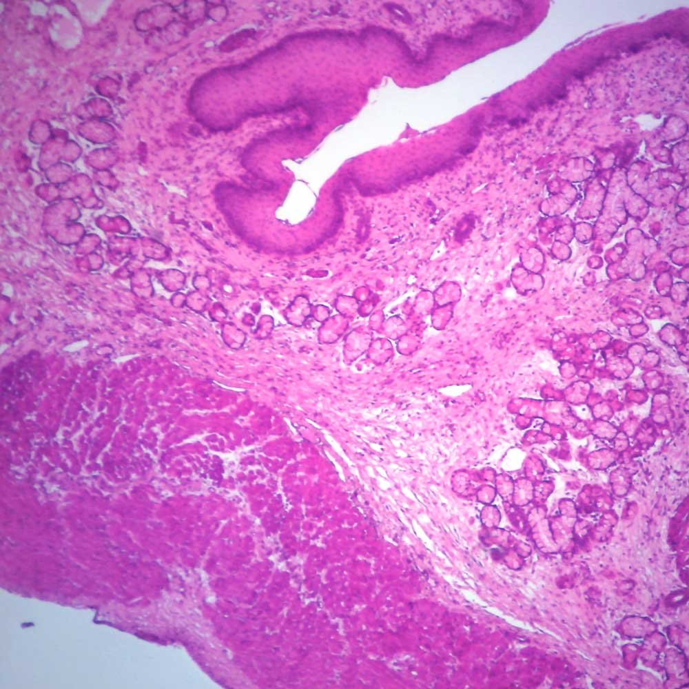 Esophagus Slide