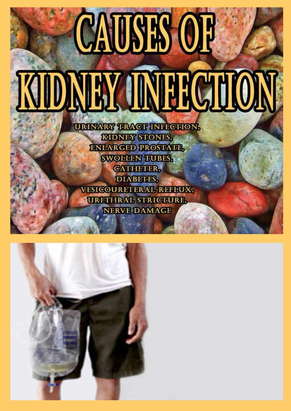 Causes Of Kidney Infection Urinary Tract Infection Kidney Stones ...