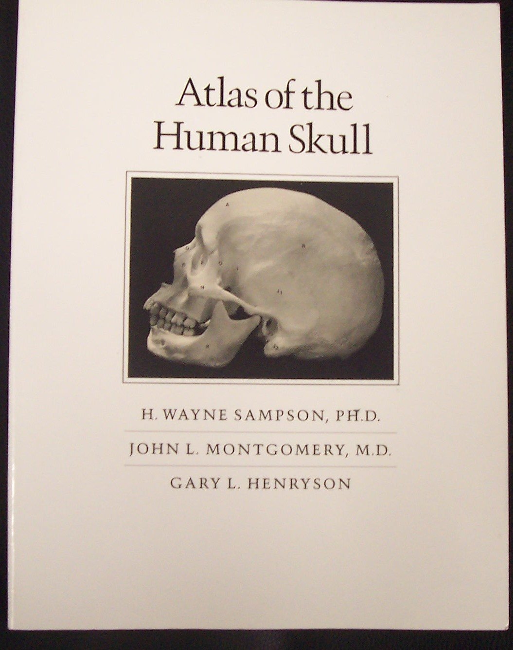 Atlas of the Human Skull: 9780890964880: Medicine & Health Science ...