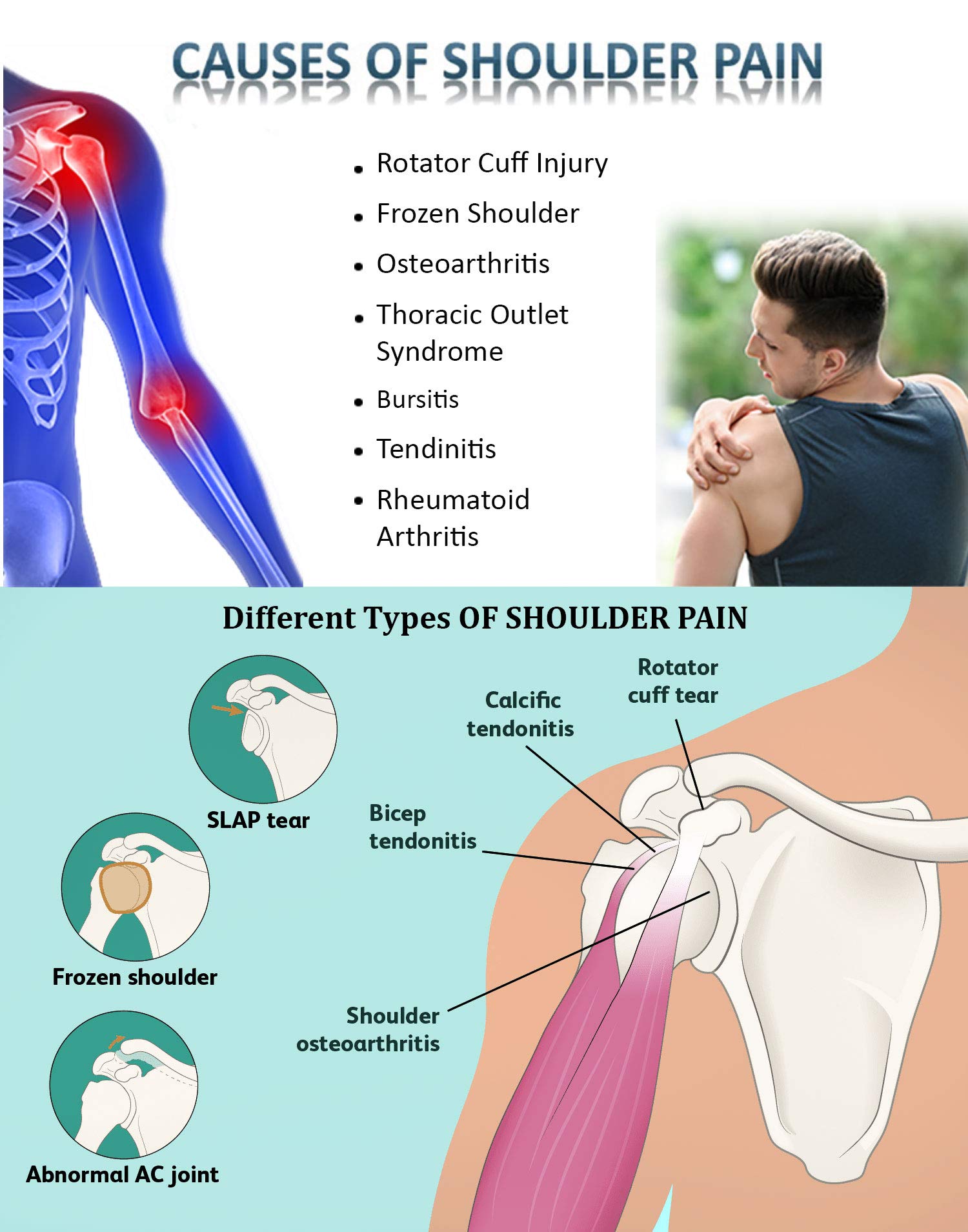 Wonder Care-Left Right Shoulder Immobilizer Arm Sling Elastic Brace for ...