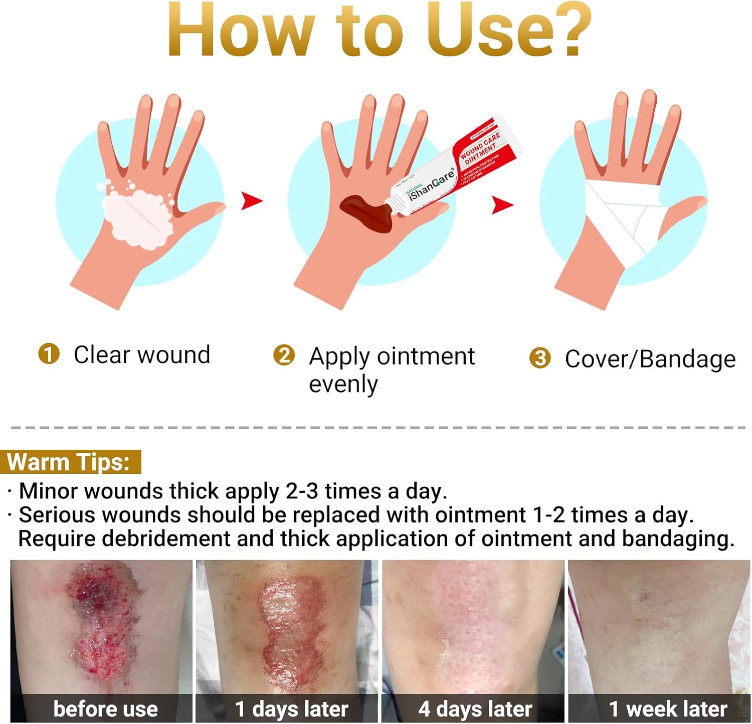 iShanCareÂ® Wound Care Ointment - Fast Healing Australia | Ubuy