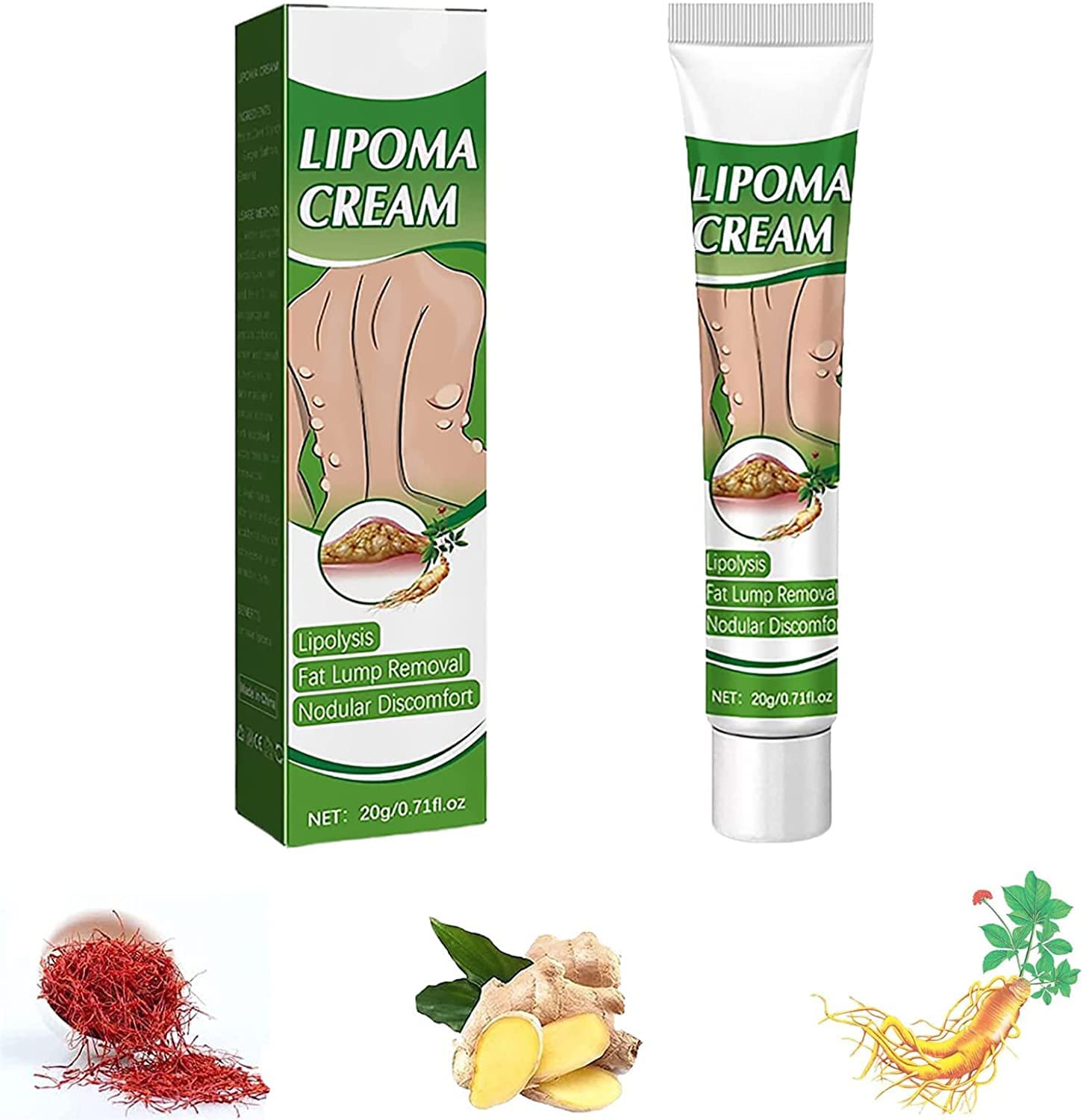 Buy LipomaCure Soothing Ointment,LumpFree Lipoma Removal Cream,al ...