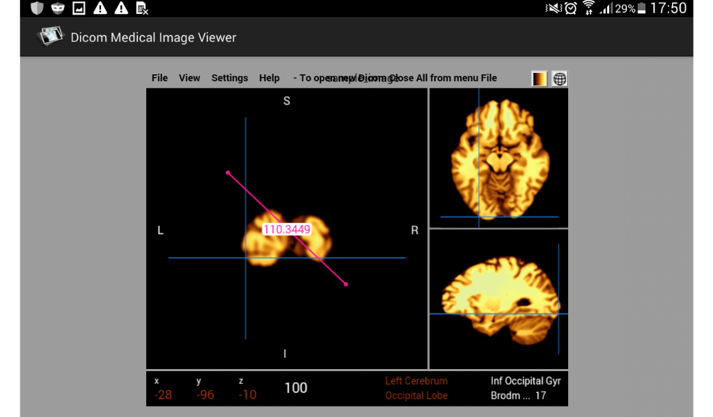 Dicom Medical Image Viewer - App on Amazon Appstore
