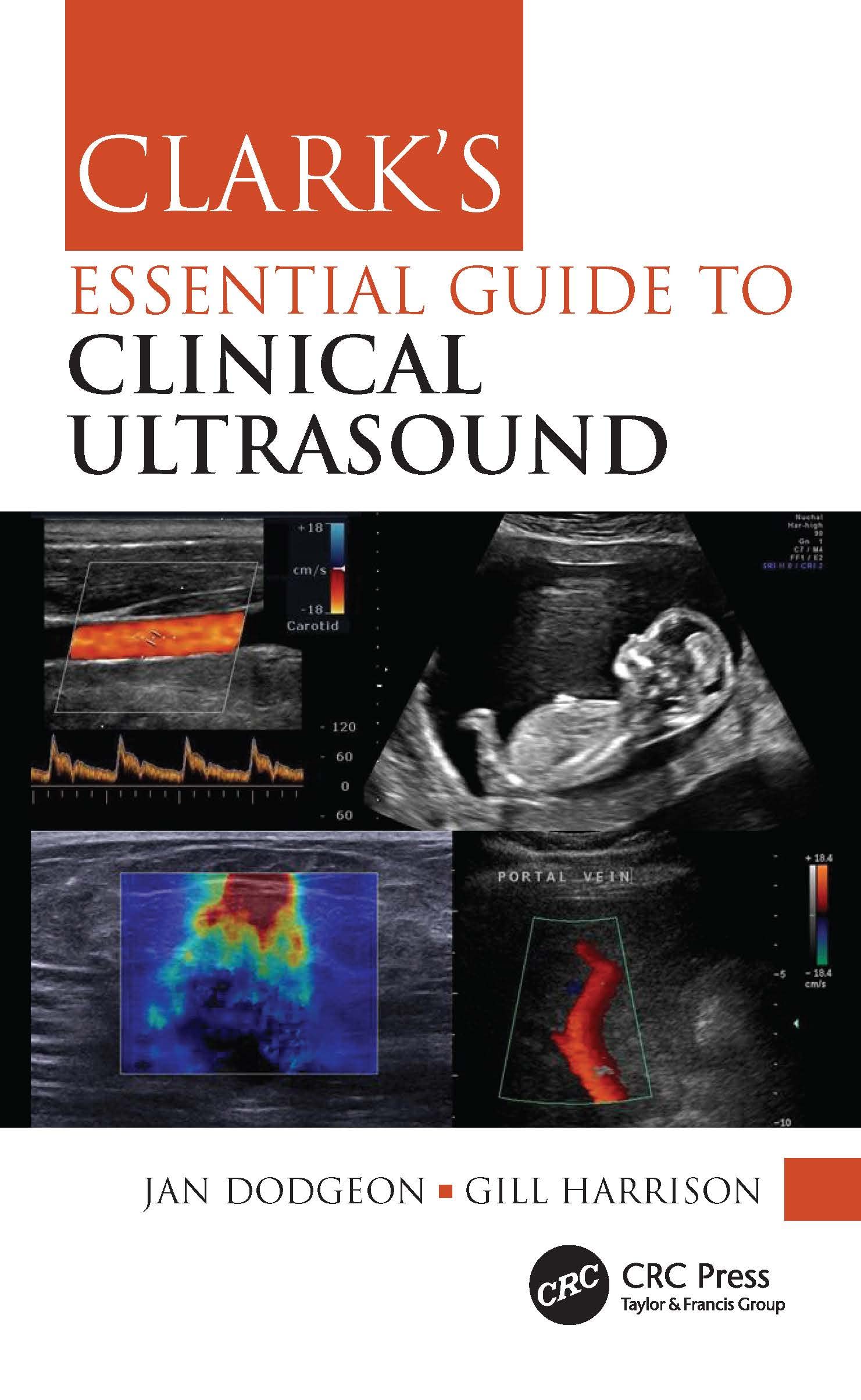 Buy Clark's Essential Guide to Clinical Ultrasound Book Online at Low ...