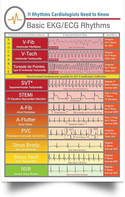 Amazon.com: Basic EKG-ECG rhythms Knowledge Vertical Wall Art Print ...