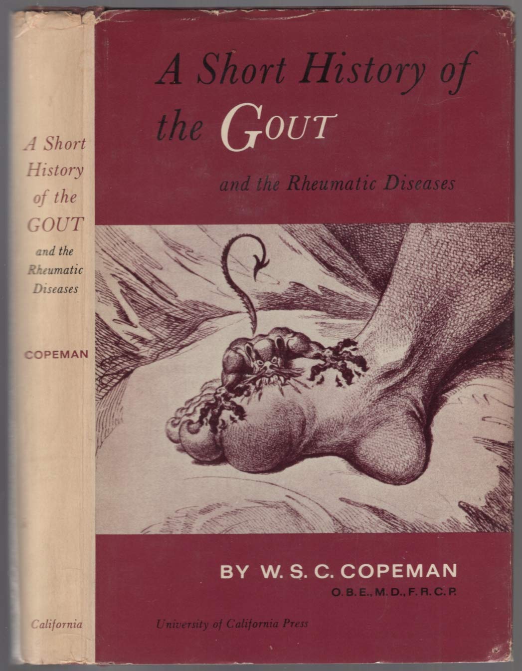 Short History of Gout and Rheumatic Diseases : Copeman, William Sydney ...