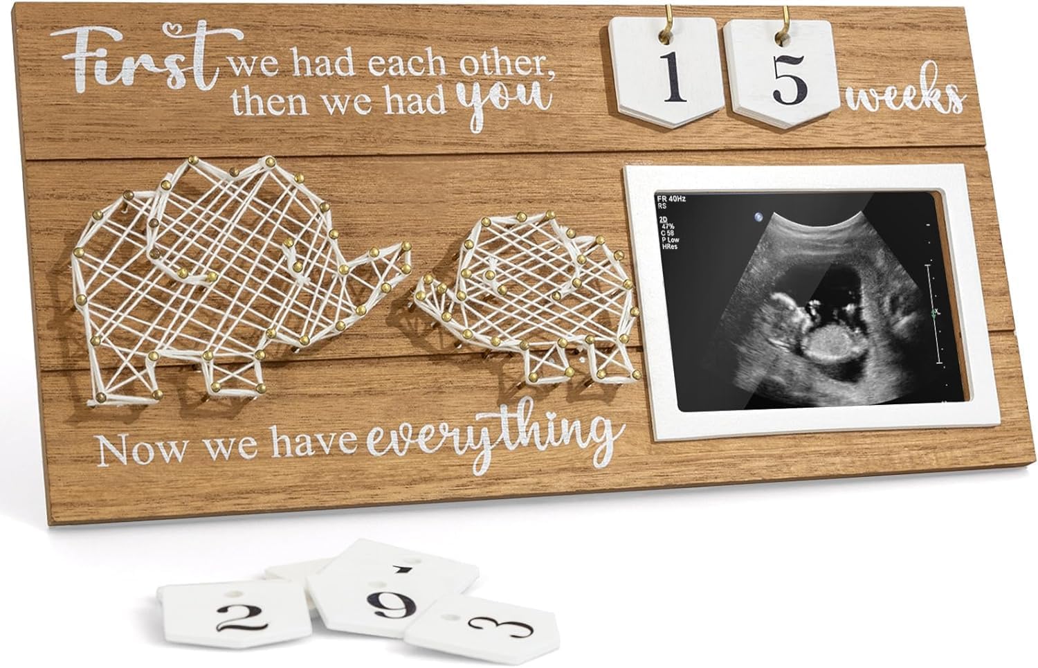 Amazon.com: Yudarte Ultrasound Picture Frame 4x3 Inches with Baby ...