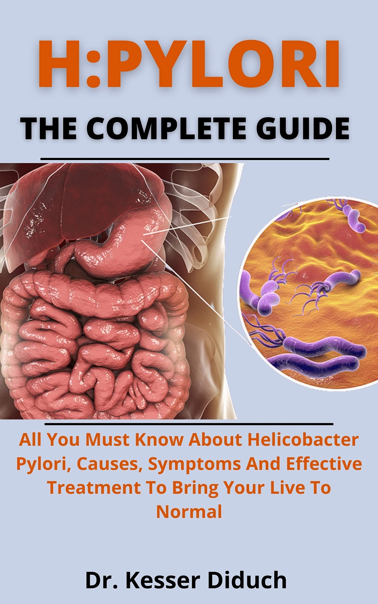 Buy H. Pylori: The Complete Guide: All You Must Know About Helicobacter ...