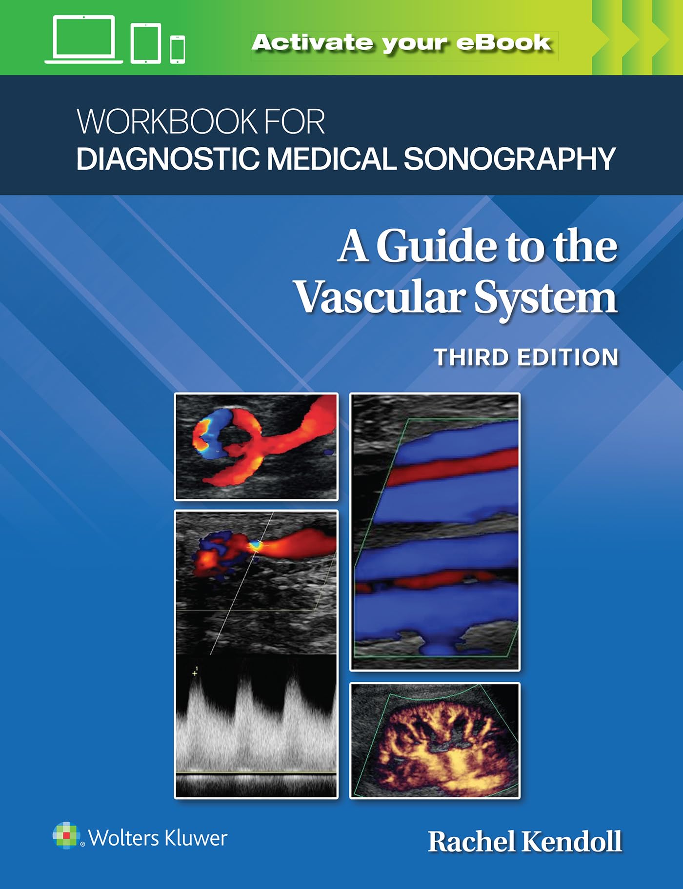 Snapklik.com : Workbook For Diagnostic Medical Sonography: The Vascular ...