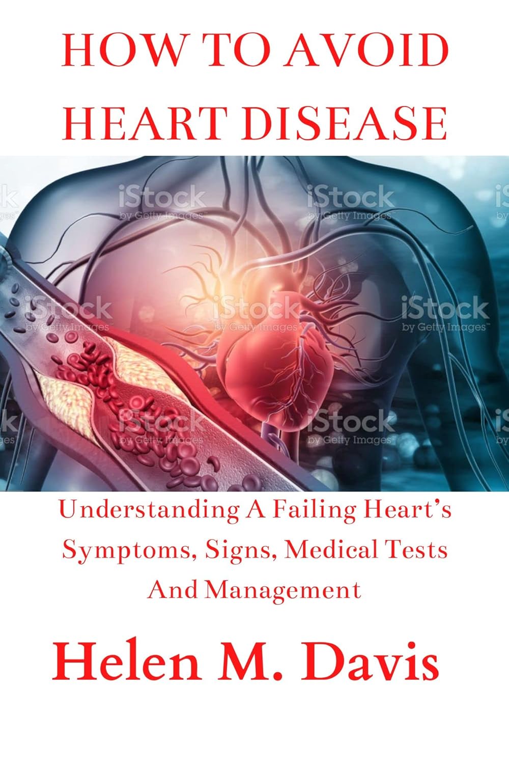 HOW TO AVOID HEART DISEASE : Understanding A Failing Heart’s Symptoms ...