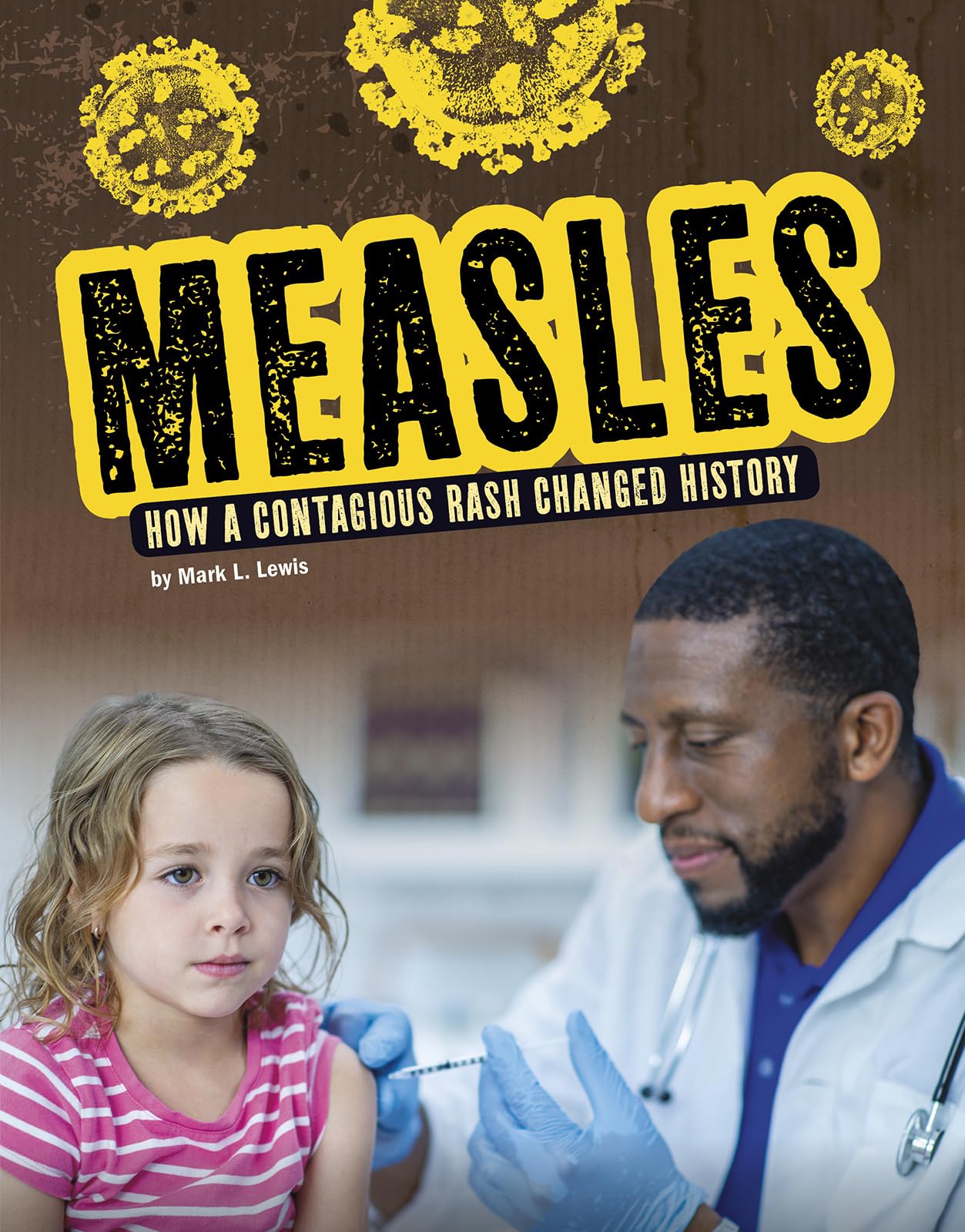 Measles: How a Contagious Rash Changed History (Infected!): Lewis, Mark ...