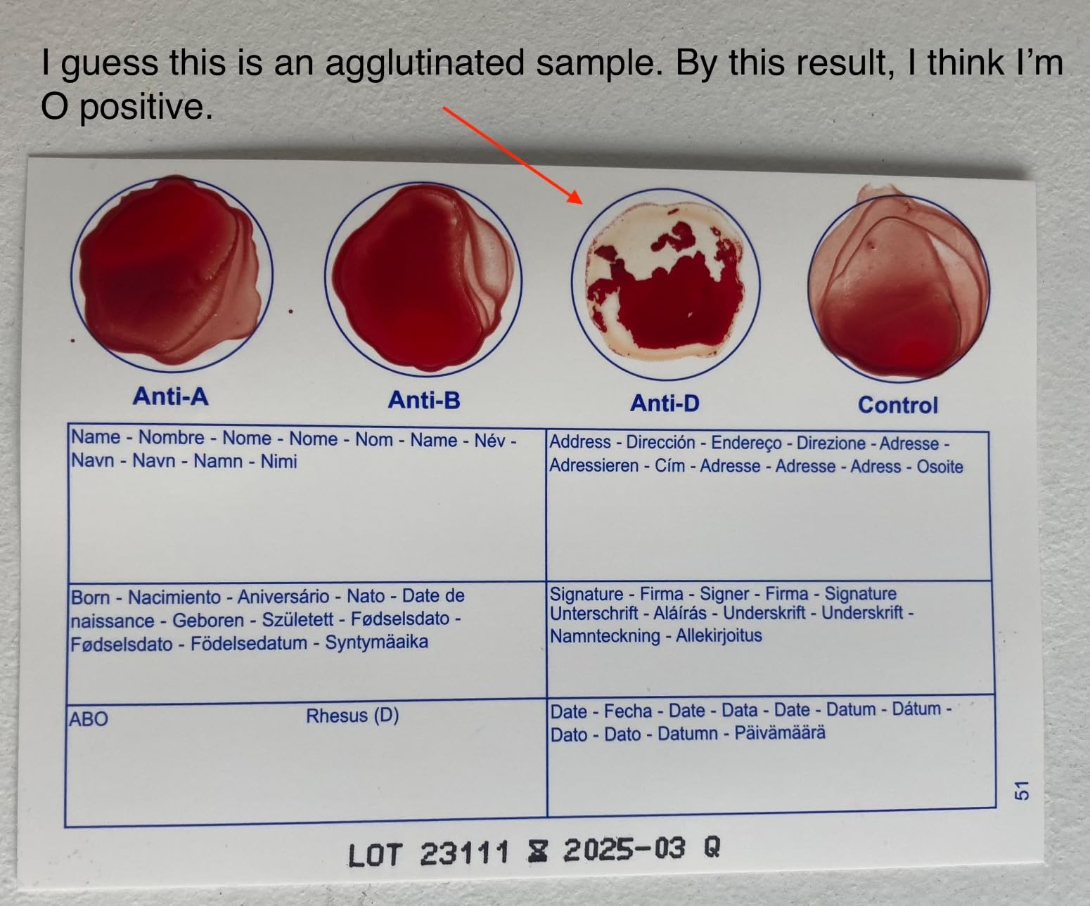 $4/mo - Finance Eldoncard Blood Typing Kit, 2 Tests, Know Your Blood ...