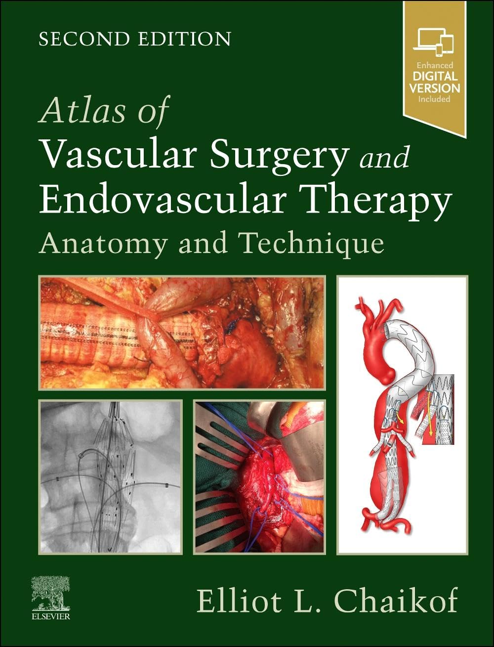 Atlas of Vascular Surgery and Endovascular Therapy: Anatomy and ...