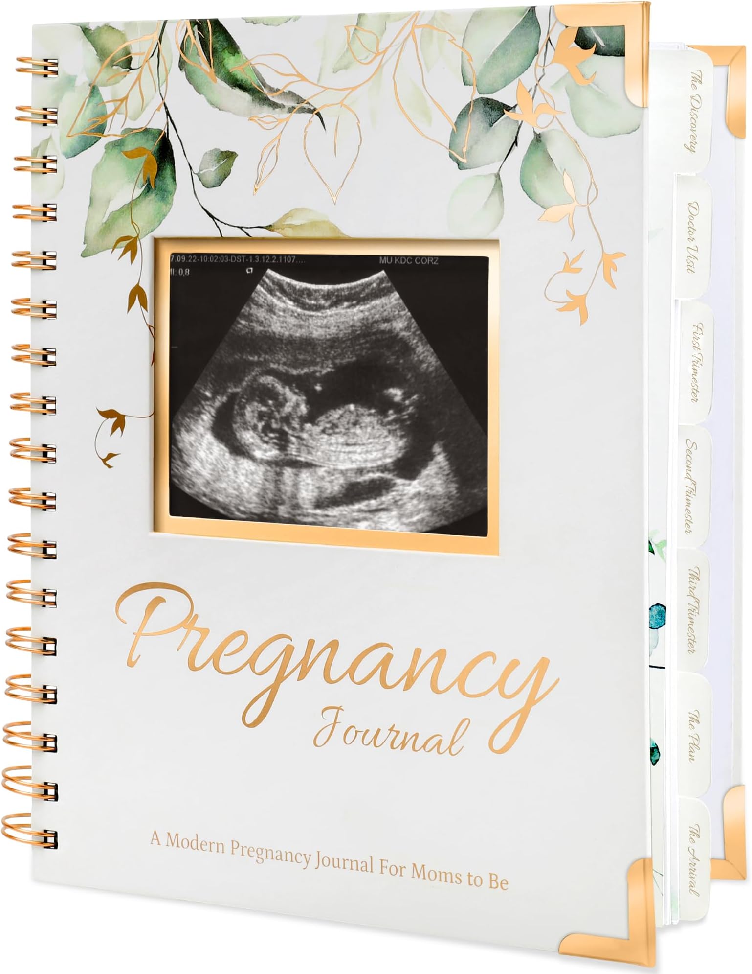 Amazon.com: My Belly Book | Pregnancy Journal Memory Book with Stickers ...