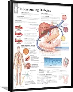 Amazon.com: AllPosters Wall Poster Understanding Diabetes Educational ...