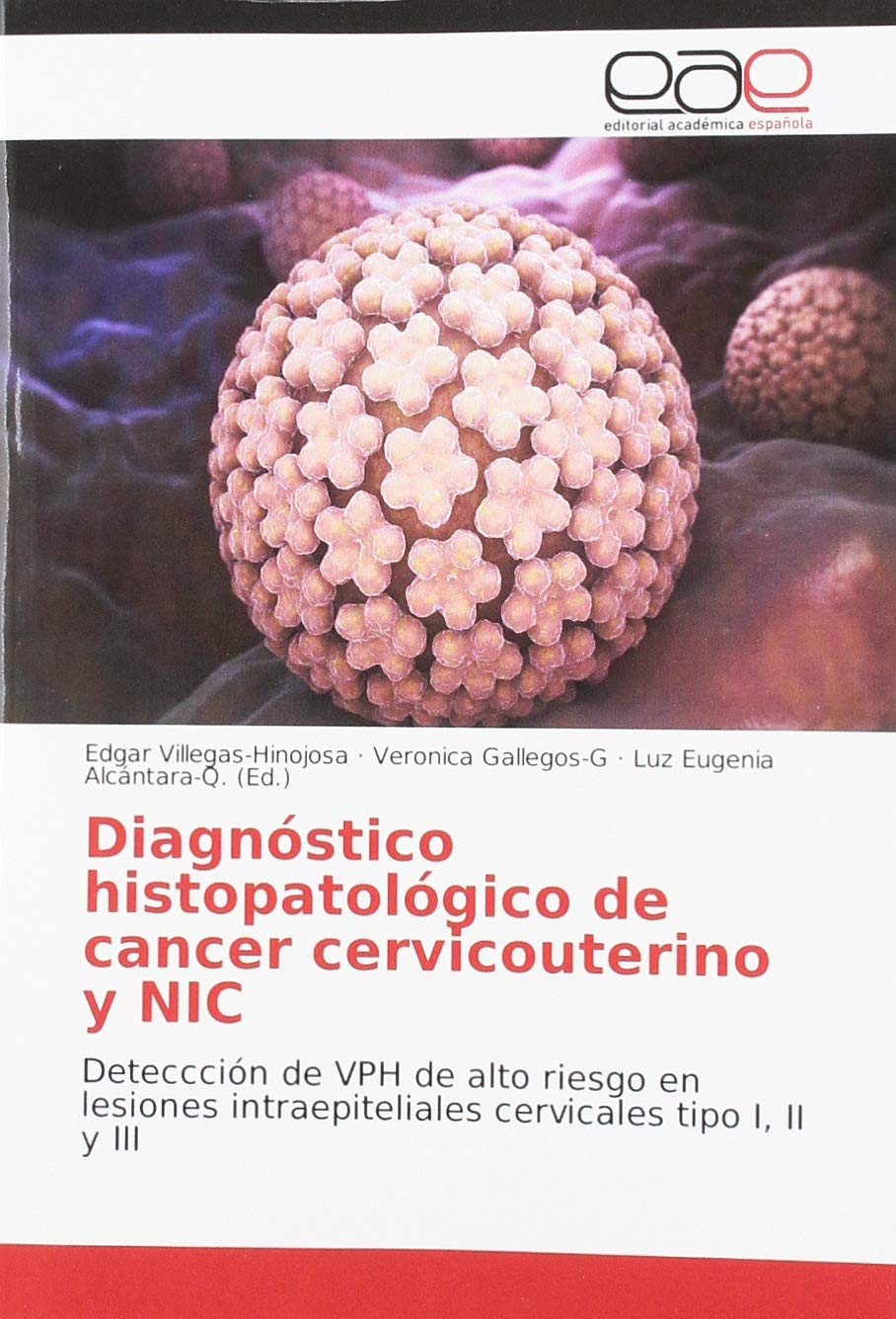 Buy Diagnóstico histopatológico de cancer cervicouterino y NIC ...
