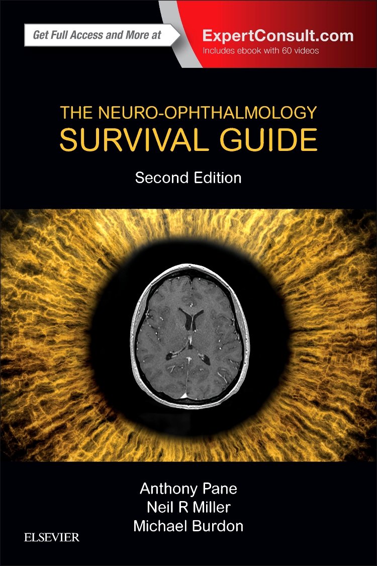 Buy THE NEURO OPHTHALMOLOGY SURVIVAL GUIDE 2ED (PB 2018) Book Online at ...