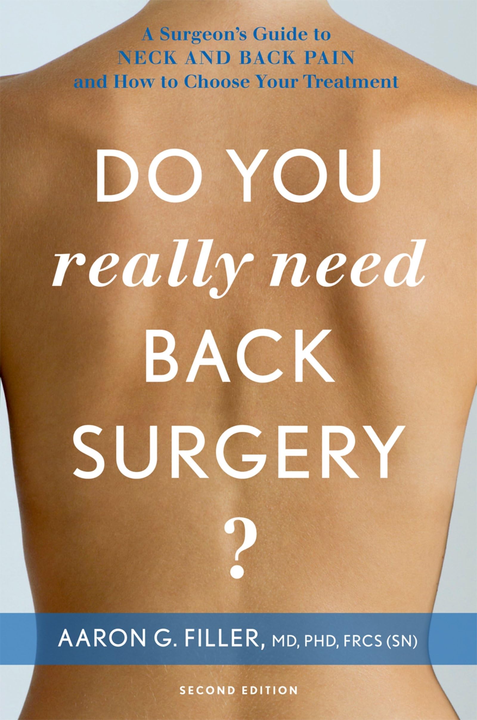Do You Really Need Back Surgery?: A Surgeon's Guide to Neck and Back ...