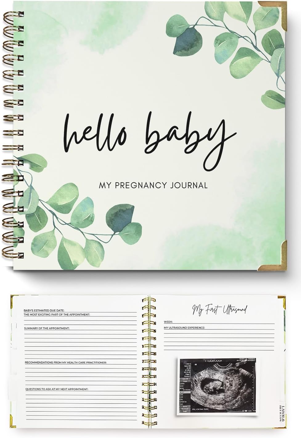 Amazon.com: Pregnancy Journals for First Time Moms - 118 Pages ...