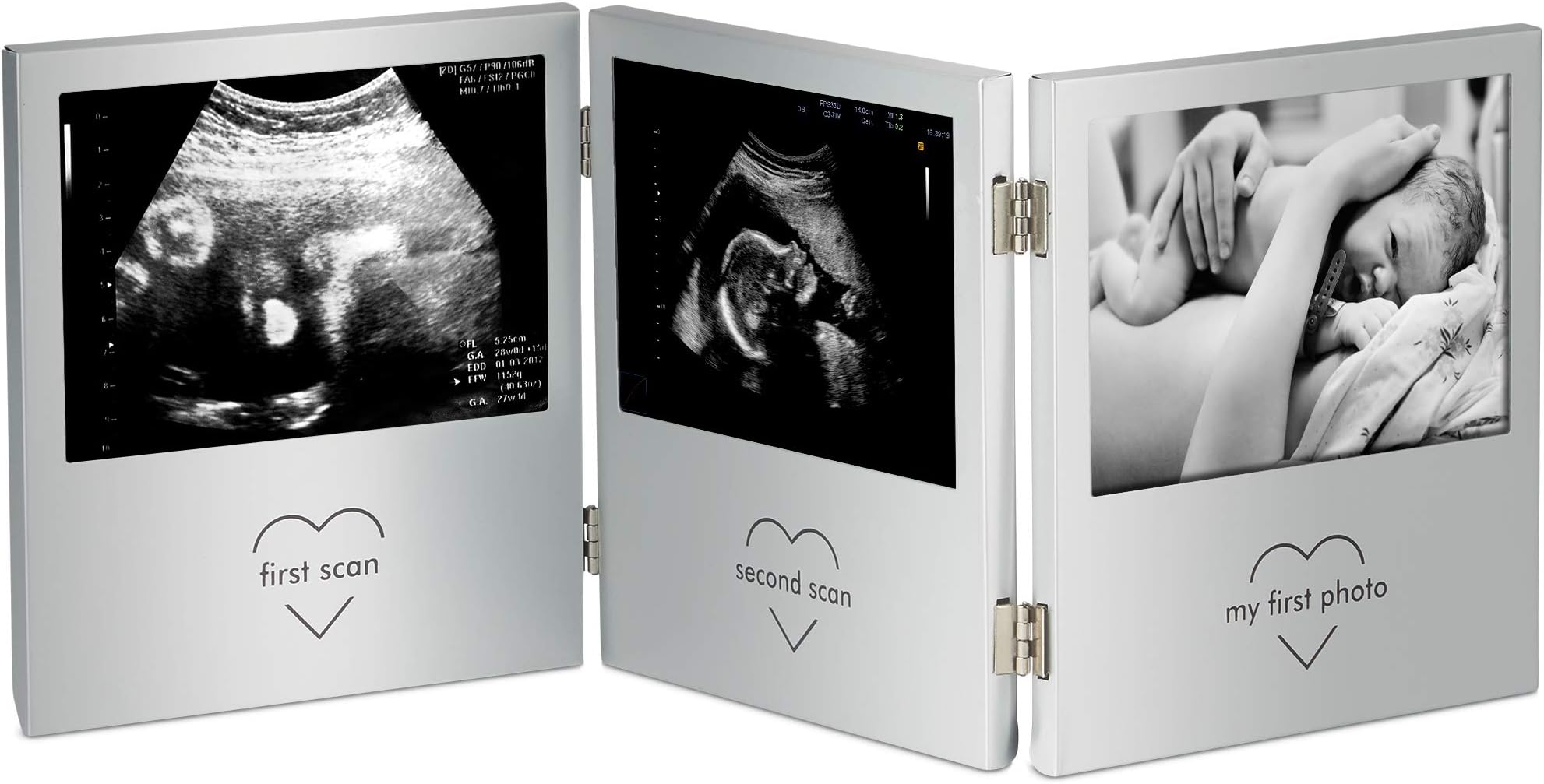 Amazon.com: VonHaus Triple Sonogram Picture Frame for Keepsake ...